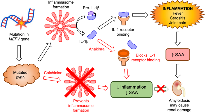Prof. Dr. Haydar BAĞIŞ / Ailevi Akdeniz Ateşi (FMF) Genetik Geçişli ...